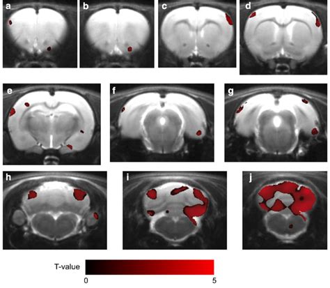 Voxel Based Spm Results For The T Contrast Odor Versus Baseline From A