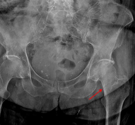 msk radiograph case 2