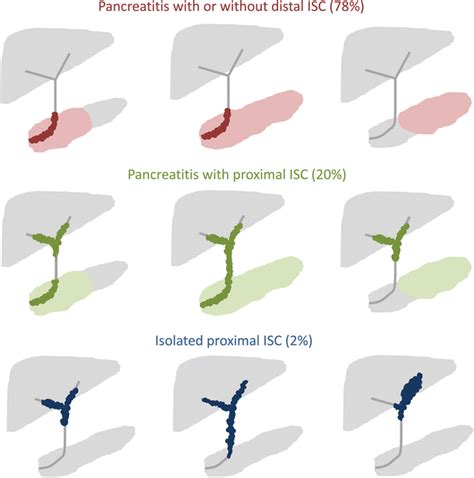 Igg4 Related Sclerosing Cholangitis All We Need To Know Springerlink