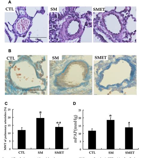 Figure 1 From Etanercept Attenuates Short Term Cigarette Smoke Exposure