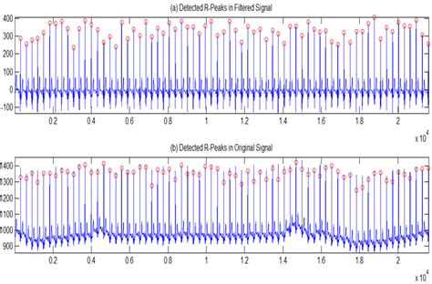 result of r peaks detection a detected r peaks in filtered signal