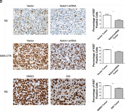 Inhibition Of Notch Signaling Decreases Rms Tumorigenesis In Vivo