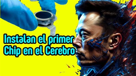 Elon Musk Instala El Primer Chip De Neuralink En Un Cerebro Humano 🤯🤯🤯