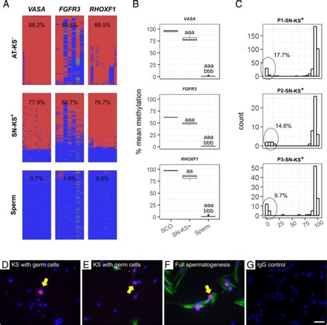 High Resolution Analysis Of Germ Cells From Men With Sex Chromosomal