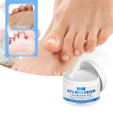 Foot Mask Remove Dead Skin For Dry Cracked Feet Callus Exfoliating