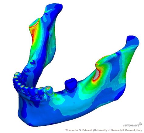 อันดับหนึ่ง 92 ภาพ ไฟไนต์เอลิเมนต์ในงานวิศวกรรม Finite Element Method