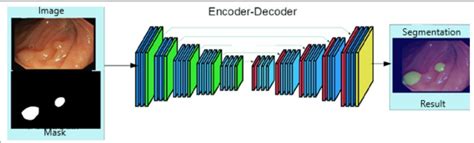 Figure 4 From Automatic Detection Of Colorectal Polyps Using Transfer