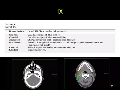 Delineation Of Nodal Volumes And Oars A Problem Based Approach Ppt