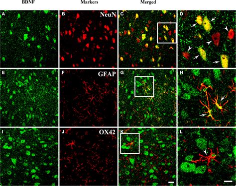 Fluorescent Photomicrographs Show Both Neurons And Astrocytes Express