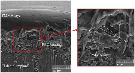 Cross Sectional Sem Micrographs Of Pmma Layer On The Peo Coated Ti