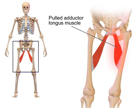 Groin Strain Symptoms Treatment And Recovery