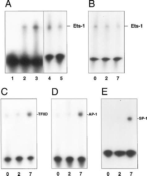 Role Of The Ets 1 Transcription Factor During Activation Of Rat Hepatic