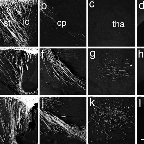 The Deep Layers Of Fezf2 Mice Show Increased Expression Of Satb2