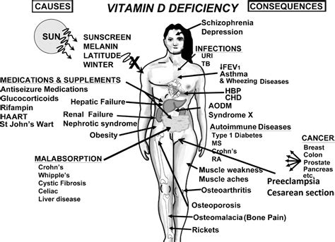 Vitamin D A D Lightful Solution For Health Michael F Holick 2011