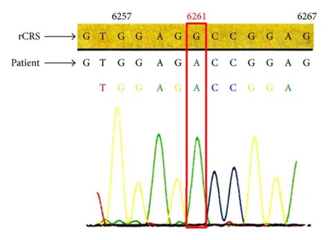 The Mtdna Sequencing Chromatogram Shows The Presence Of The G→a