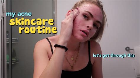 My Skincare Routine For Acne P Vlogmas Episode 3 Youtube
