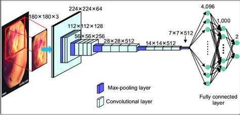 sample of a deep convolutional neural network based ulcer detection