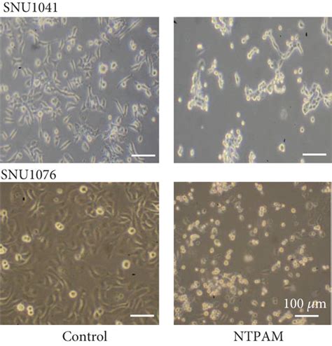 Ntpam Induced Apoptotic Cell Death In Hnc Cell Lines A Microscopic