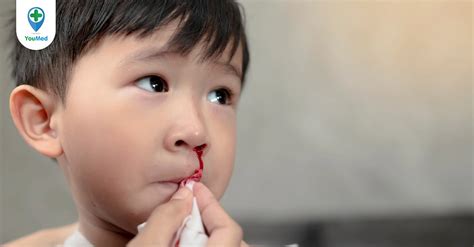 Xuất Hiện Cách Chữa Chảy Máu Cam ở Trẻ Em Nguyên Nhân Và Cách Xử Lý