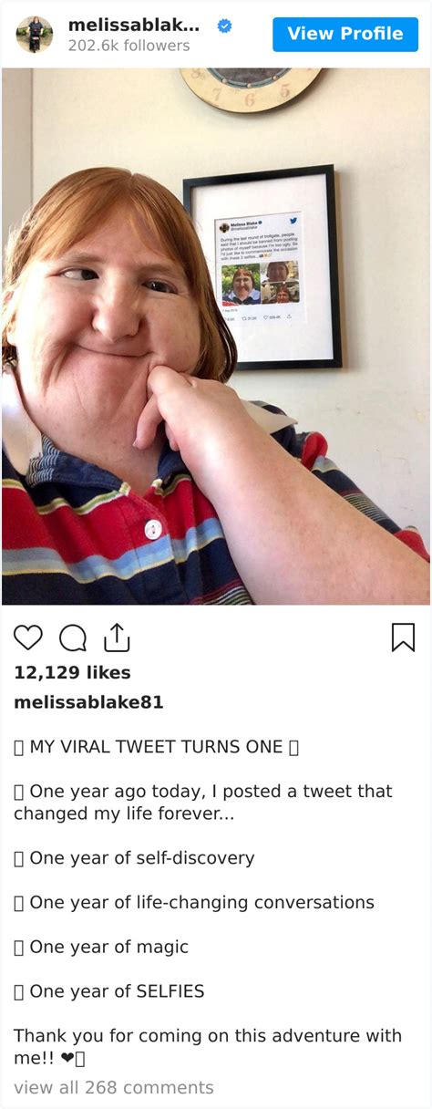 Trolls Tell Woman Shes ‘too Ugly To Be Posting Pics Of Her Face She