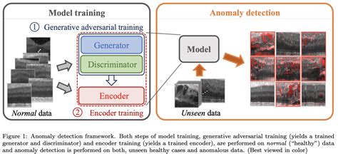 [f anogan] fast unsupervised anomaly detection with gan