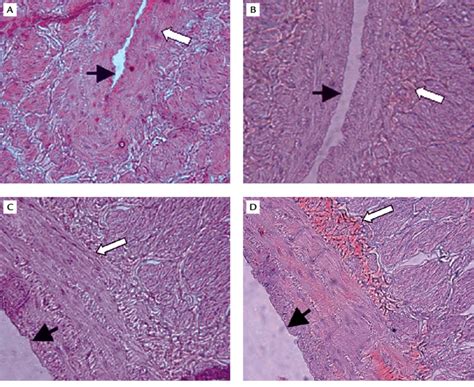 Micrographs Of Representative Internal Spermatic Vein Isv Sections