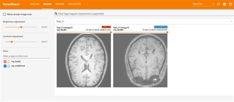 nifty assignment training a neural network for medical image