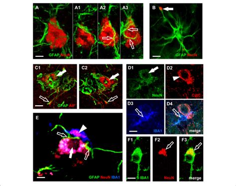 Characterization Of Neurons Astrocytes Microglia Interplay And