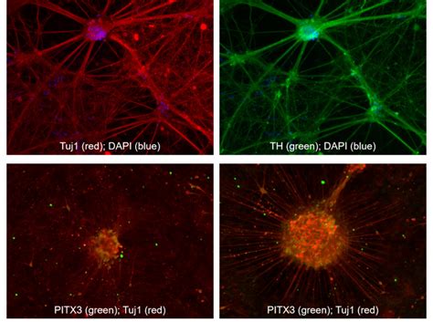 Generation Of Ipsc Derived Parkinsons Disease Neurons