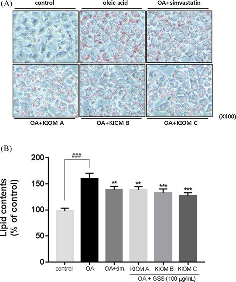 Effects Of Gss On Lipid Accumulation Induced By Oa In Hepg2 Cells A