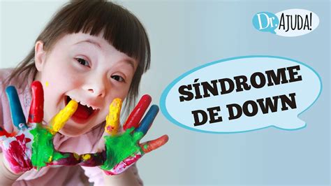 GenÉtica Riscos E CaracterÍsticas O Que É SÍndrome De Down Youtube