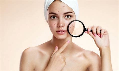 Tips Memilih Skin Care Yang Cocok Untuk Kulit Wajahmu