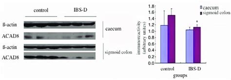 Western Blot Analysis Of Acad8 In Sigmoid Colon And Caecum Of The Ibs D