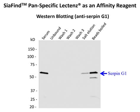 Discover Lectenz Bio Simplifying Glycan Detection With Recombinant
