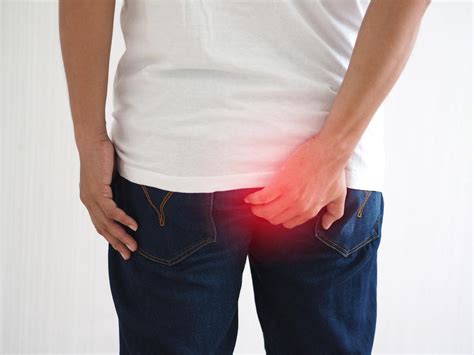 Top Signs Of A Thrombosed Hemorrhoid Betsy F Clemens M D Board