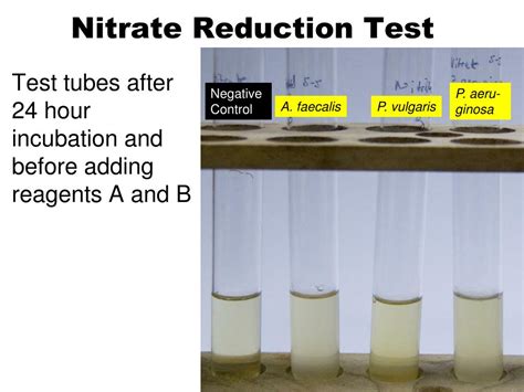 Ppt Ex 17 Nitrate Respiration Nitrate Reduction Test Powerpoint