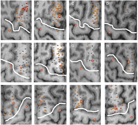 Frontiers Protocol For Mapping Of The Supplementary Motor Area Using
