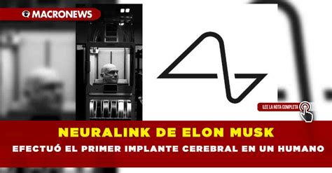 Neuralink De Elon Musk EfectuÓ El Primer Implante Cerebral En Un Humano