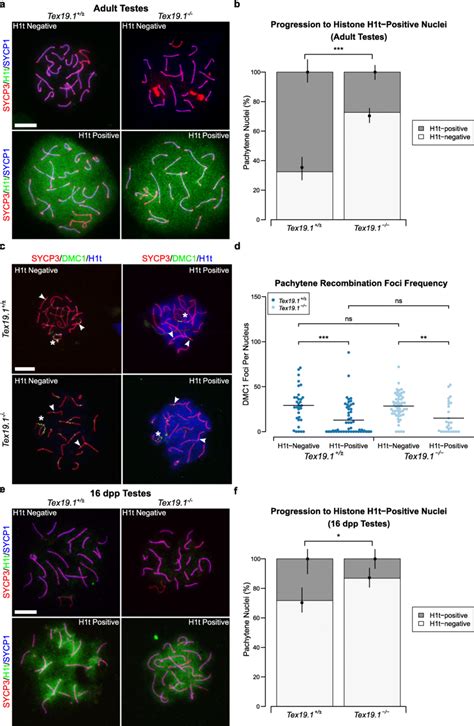 Expression Of The Mid Late Pachytene Marker Histone H1t Is Delayed In