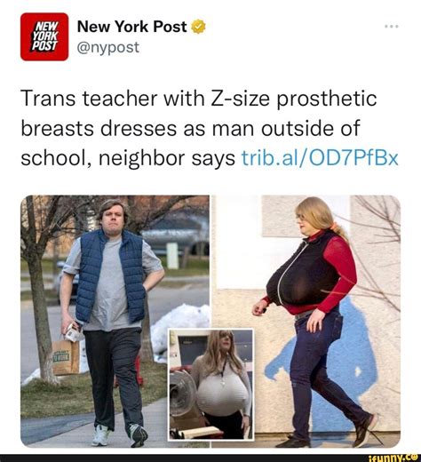 New York Post Post Trans Teacher With Z Size Prosthetic Breasts Dresses
