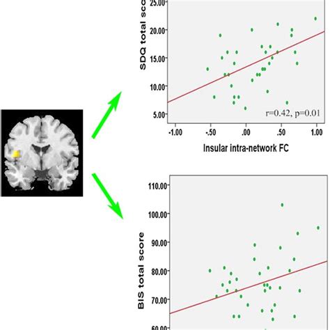 Correlations Of Insular Intra Network Functional Connectivity With