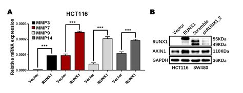 Runx1 Promotes Tumour Metastasis By Activating The Wnt β Catenin
