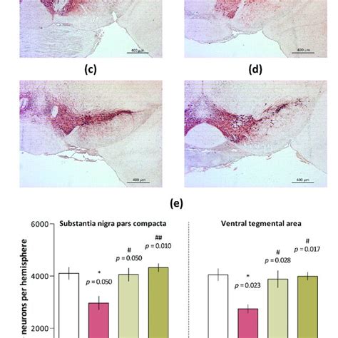 Post Mortem Analysis Of The Number Of Dopaminergic Neurons In The Mice