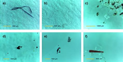 Llustrating The Types Of Microplastics Identified In The Tecolutla