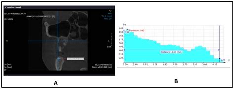 applied sciences free full text comparing the diagnostic accuracy