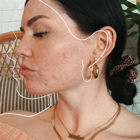 10 Skin Positive Influencers To Follow Glamour Uk