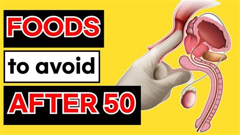 10 Foods To Avoid For Prostate Cancer And Enlarged Prostate Youtube
