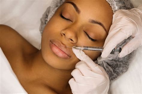 Quanto Tempo Dura O Preenchimento Labial E Como é Feito Clinica