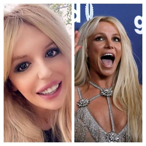 In La Man Spends Over Rm500 000 On Plastic Surgery To Look Like