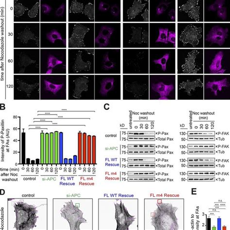 Expression Of Mutant M4 Fl Apc Causes Severe Defects In Directed Cell